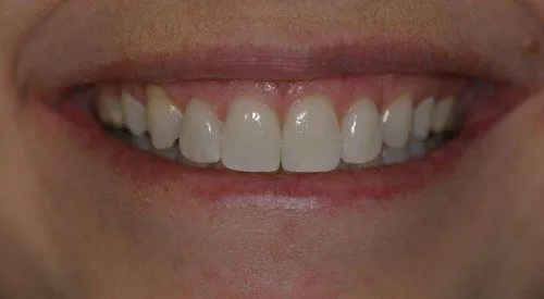 Smile Gallery Skokie IL, Old Orchard Periodontics and Implant Dentistry